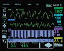 ZOLL X Series – The Defib Store